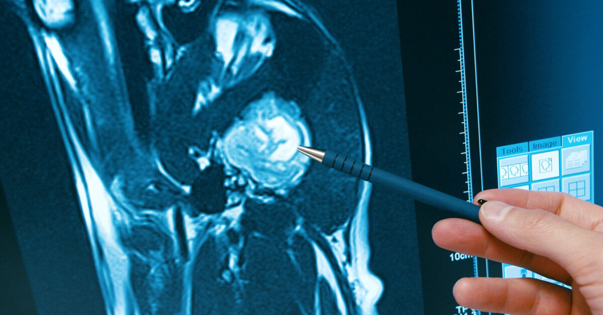 ICG invests in Alfa Medicus to fund growth of synergistic healthcare ...